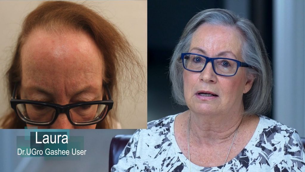 Gashee Hair Stories: I couldn't Believe Really...It was Really A Mirac